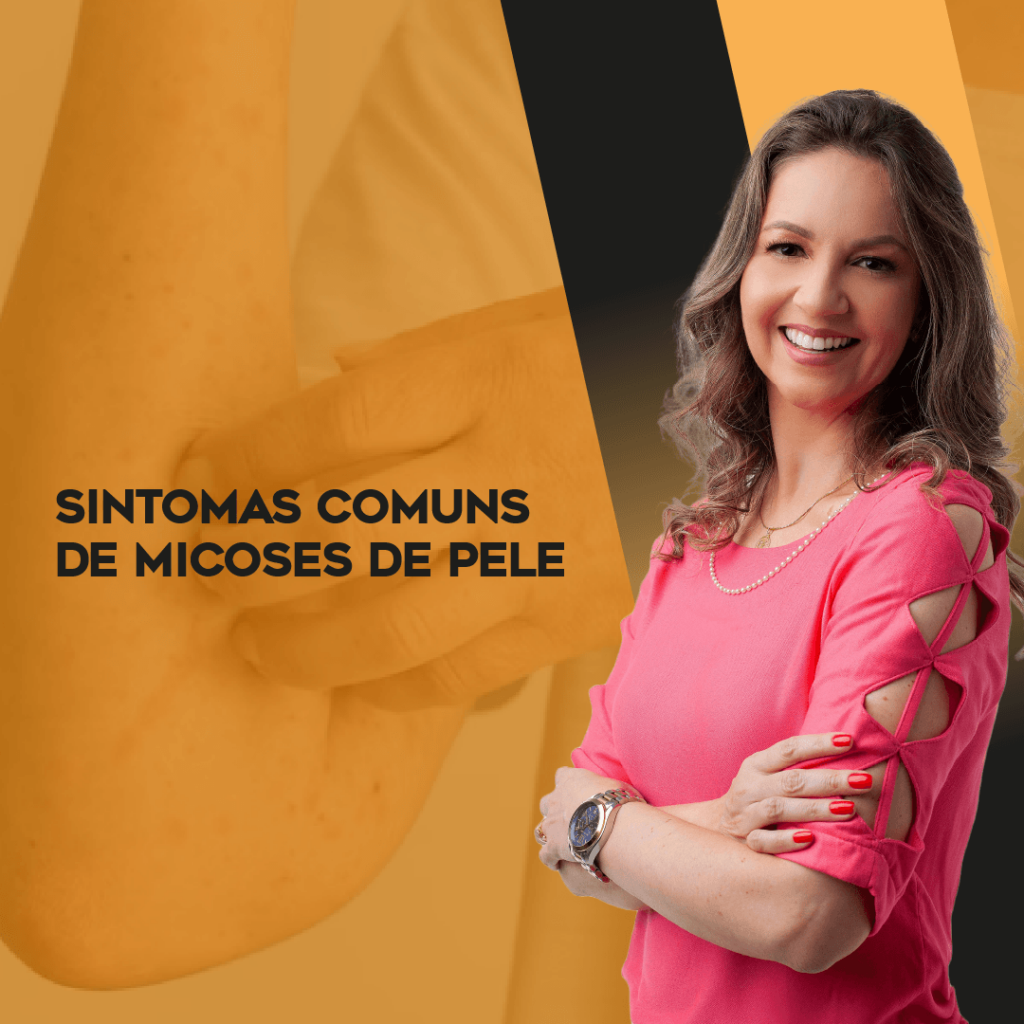 Sintomas comuns de micoses de pele – Dra. Priscila Rettore